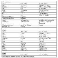 Macrophage activation syndrome Case Study | Immunopaedia