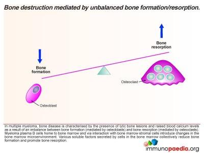 bone-destruction-mediated-by-unbalanced-bone-formation | Immunopaedia