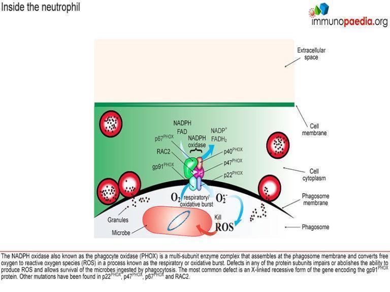 Chronic Granulomatous Disease Case Study | Immunopaedia