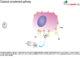 Complement Deficiencies Case Study | Immunopaedia