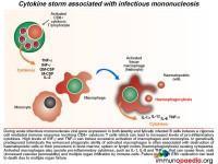 Severe Psoriasis vulgaris Case Study | Immunopaedia Immunopaedia