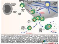 Epstein-Barr Virus Case Study | Immunopaedia