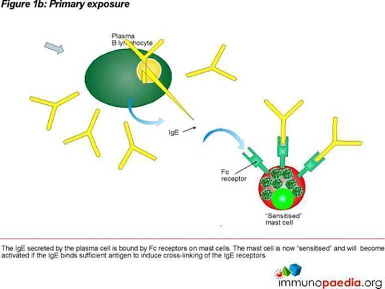 Arthus reaction Case Study | Immunopaedia