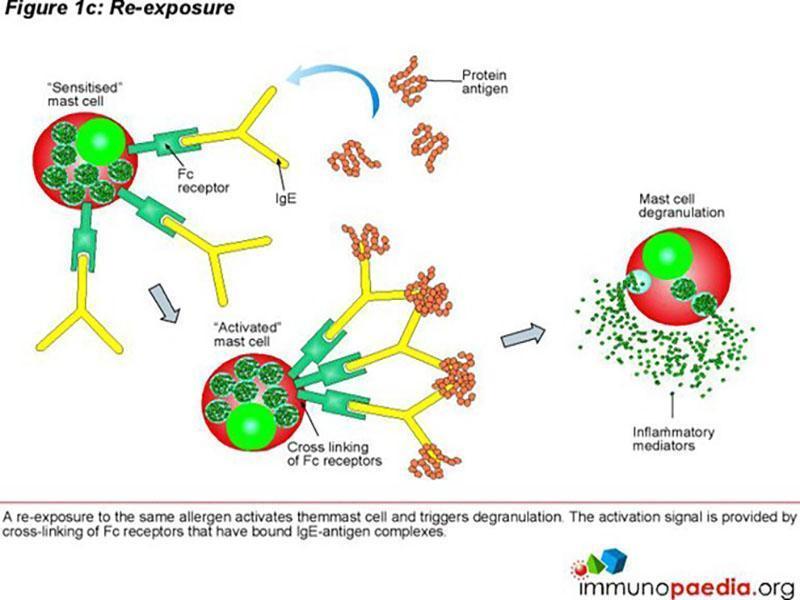 Arthus reaction Case Study | Immunopaedia