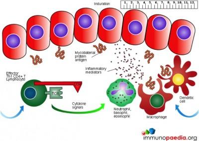 Immunology Diagnostic Tests | Immunopaedia