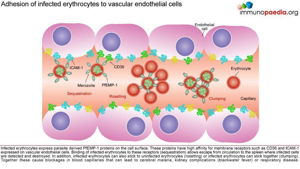 Severe P.falciparum Malaria Case Study | Immunopaedia