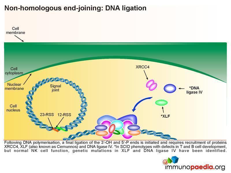 Severe Combined Immunodeficiency Case Study | Immunopaedia
