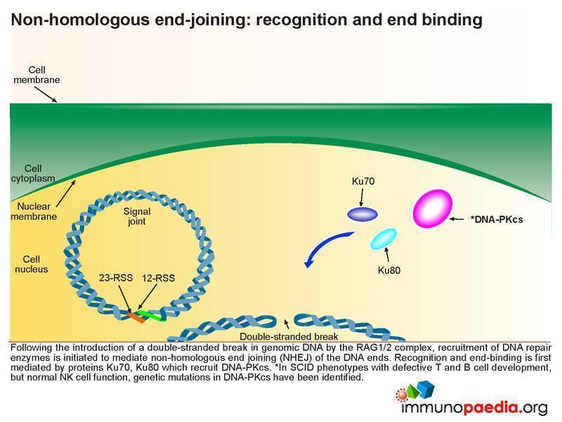 Severe Combined Immunodeficiency Case Study | Immunopaedia
