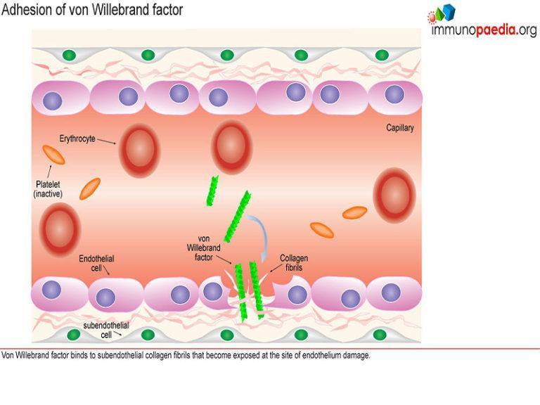 Thrombotic Thrombocytopaenic Purpura Case Study | Immunopaedia