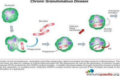 chronic-granulomatous-disease | Immunopaedia