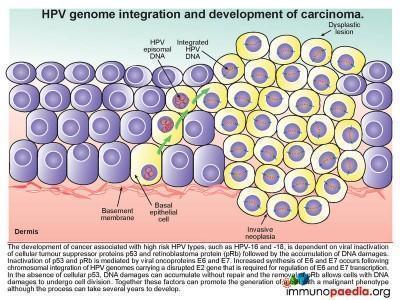 hpv-genome-integration-and-development-of-carcinoma | Immunopaedia ...
