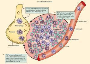 Immunity to TB | Immunopaedia Immunopaedia