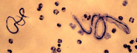 Nutritional consequence of HIV-helminth coinfection | Immunopaedia ...