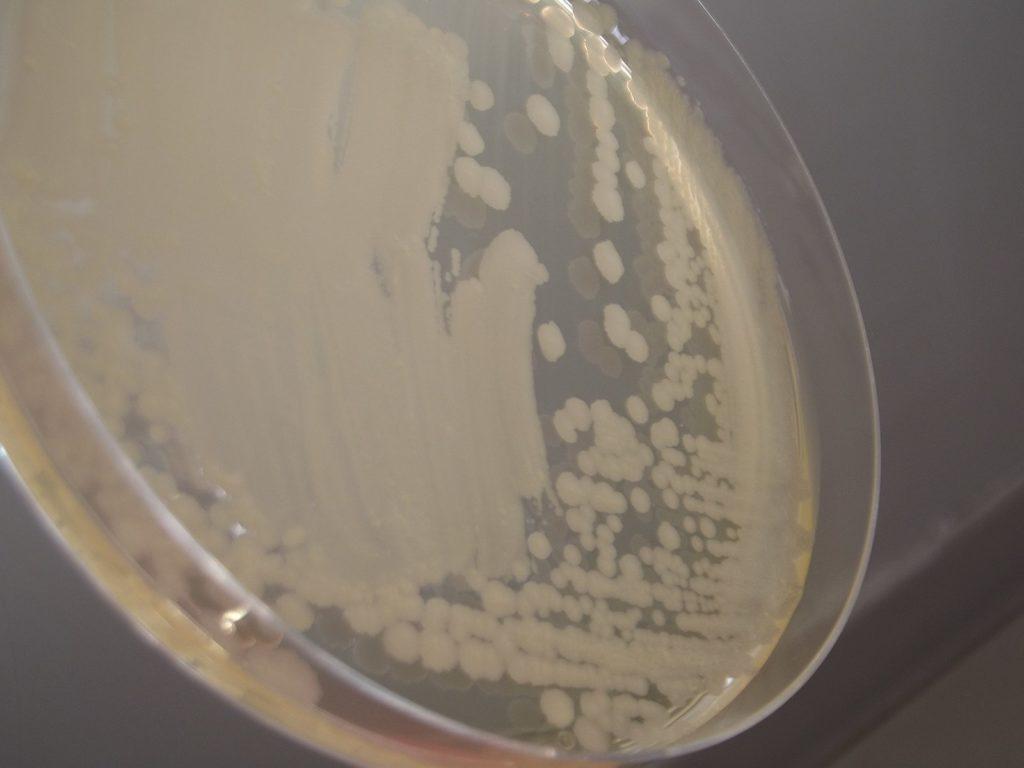 Harmless γδ T cells associated with Corynebacterium sp. can be harmful ...