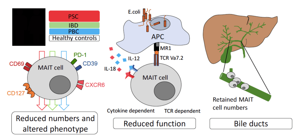 MAIT cell dysfunction during primary sclerosing cholangitis | Immunopaedia