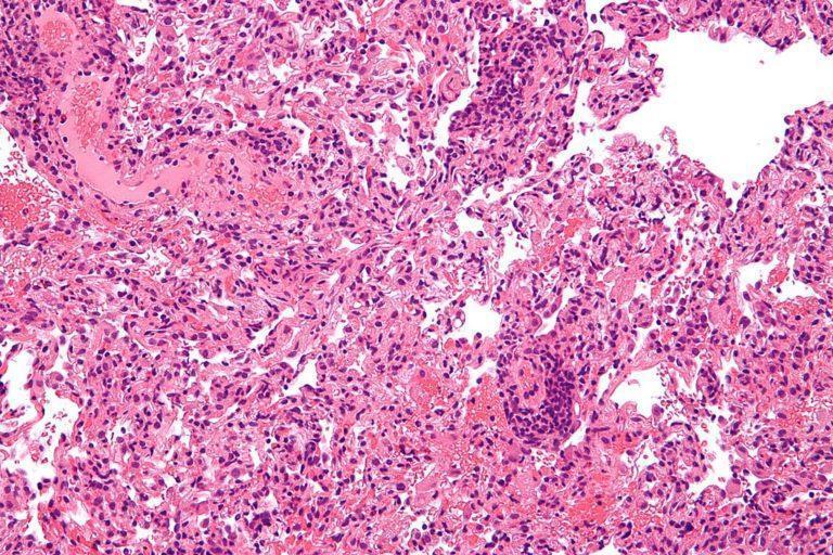 History of MHC – 1971 – 2011 | Immunopaedia