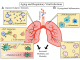 Aging & COVID-19 | Immunopaedia Immunopaedia