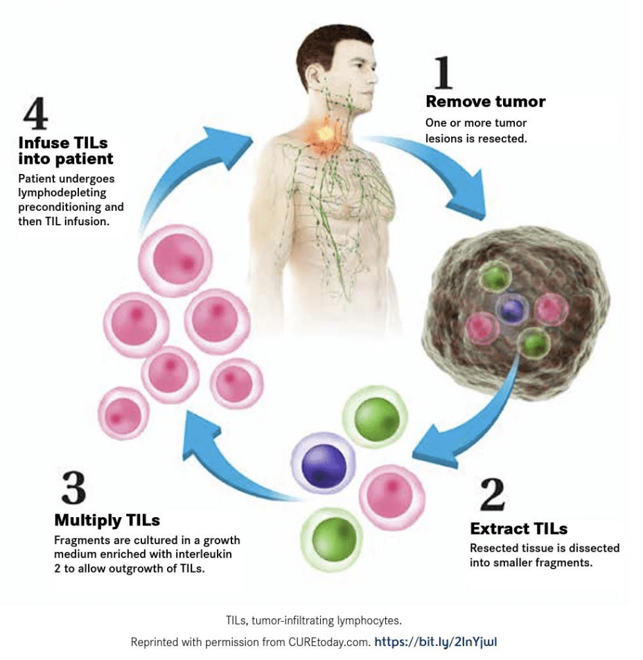 Immuno-Colombia: Tumour infiltrating lymphocyte therapy (Part 2 ...