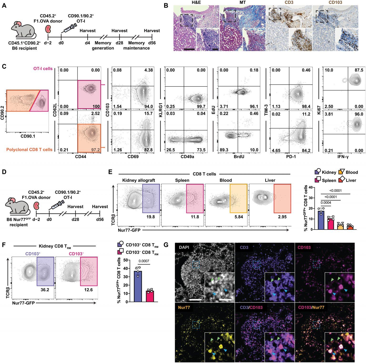 Chronic transplant rejection – new insights | Immunopaedia