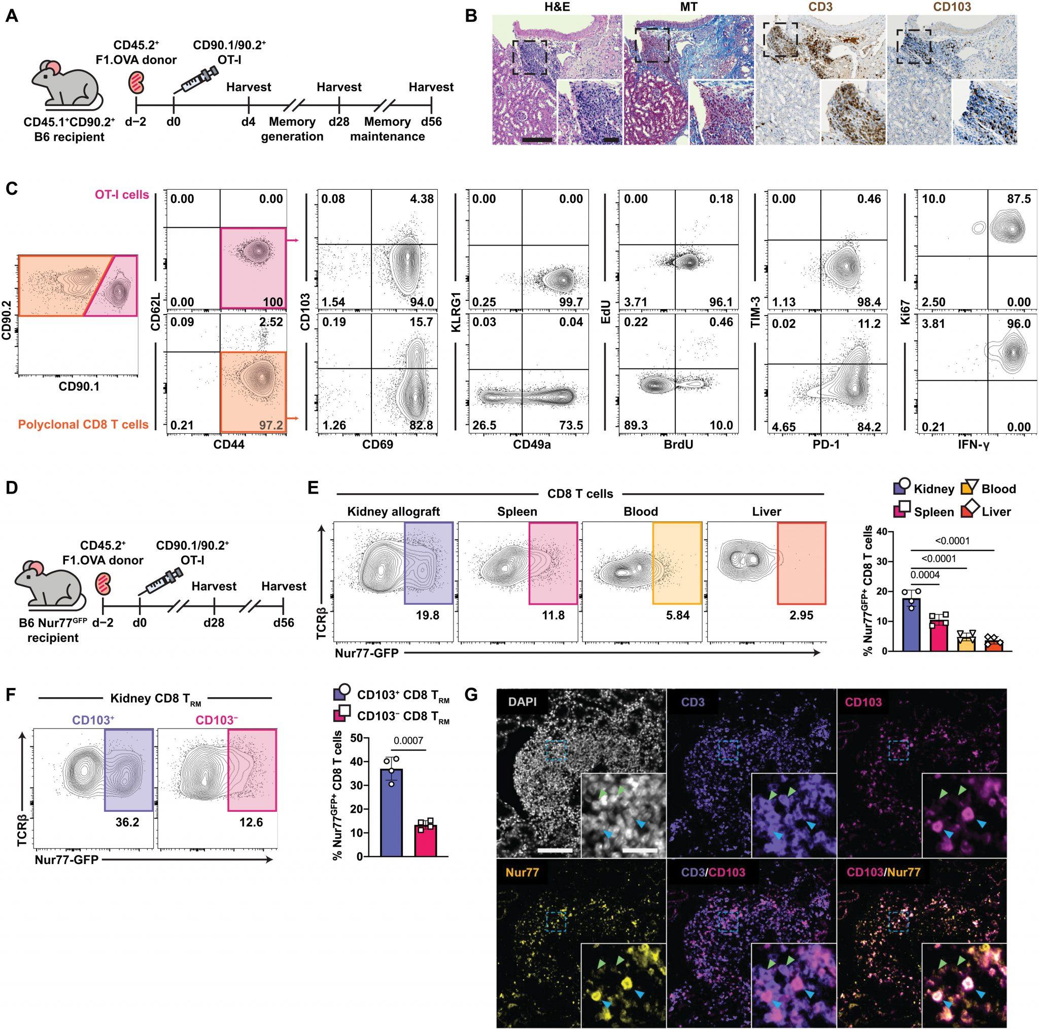 Chronic transplant rejection – new insights | Immunopaedia
