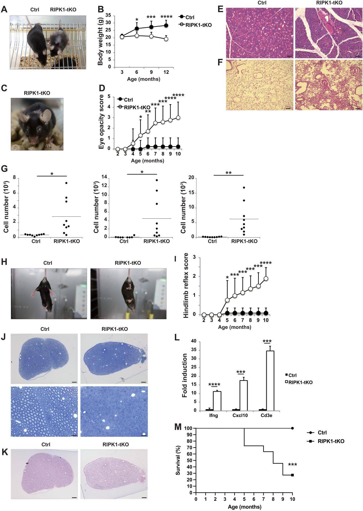 The immune system during old age | Immunopaedia