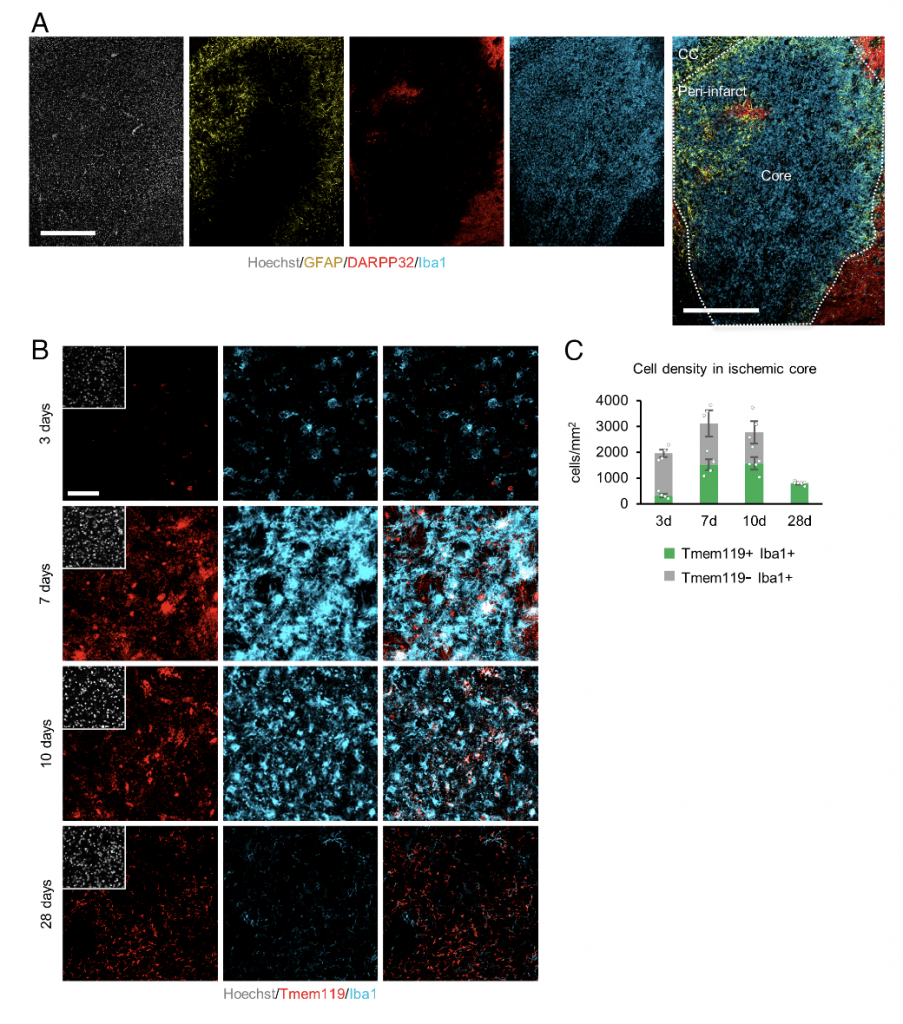 Reprogramming Brain’s Defense Cells into Neurons Aids Stroke Recovery ...