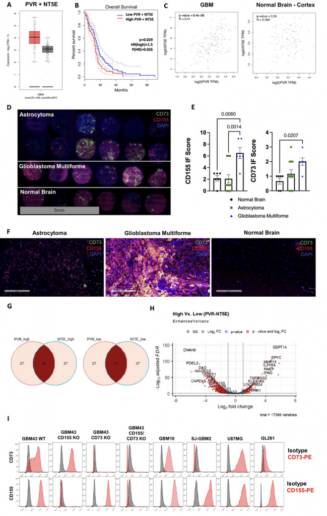 Engineered Off-the-Shelf Cells Offer New Hope for Glioblastoma ...