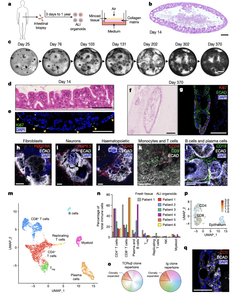 Organoid models elucidate Celiac disease pathogenesis | Immunopaedia ...