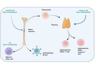 Severe Combined Immunodeficiency Case Study | Immunopaedia