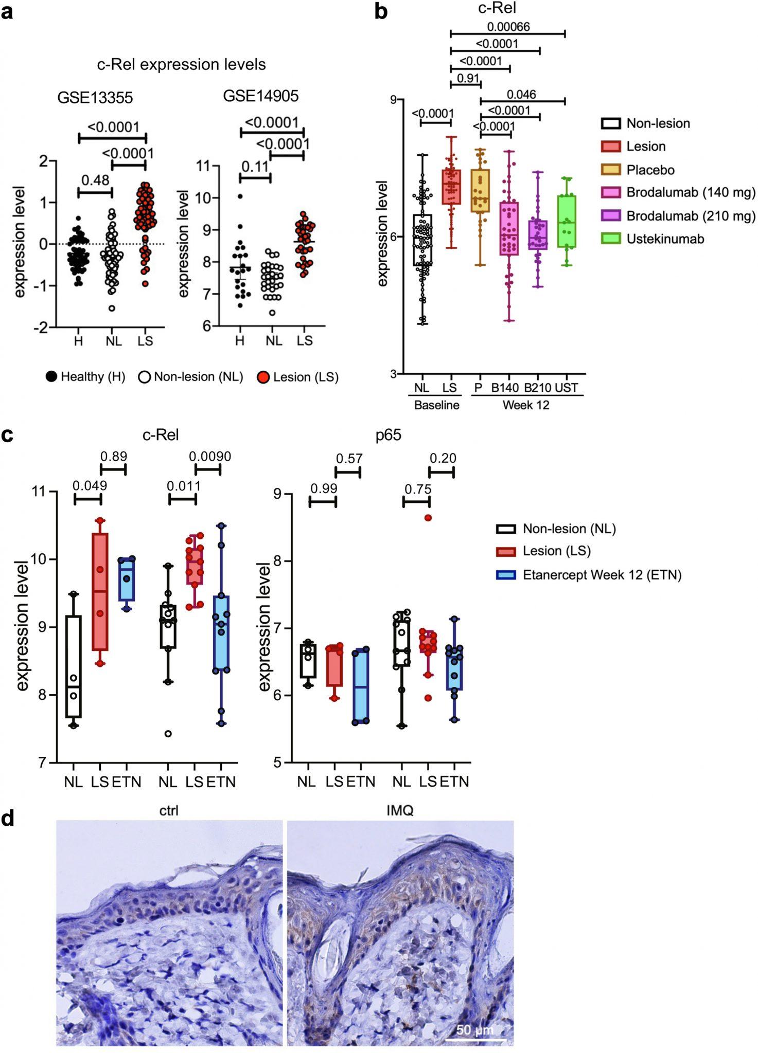 Targeting c-Rel and TLR7: A New Pathway for Psoriasis Treatment | Immunopaedia