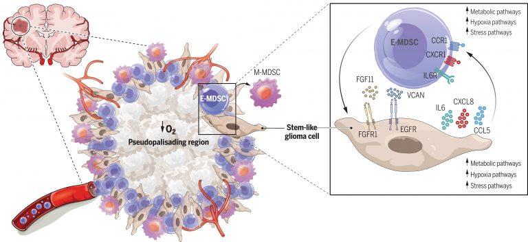 Unravelling the Immune-Tumour Cross-Talk in Glioblastoma: A New Target ...